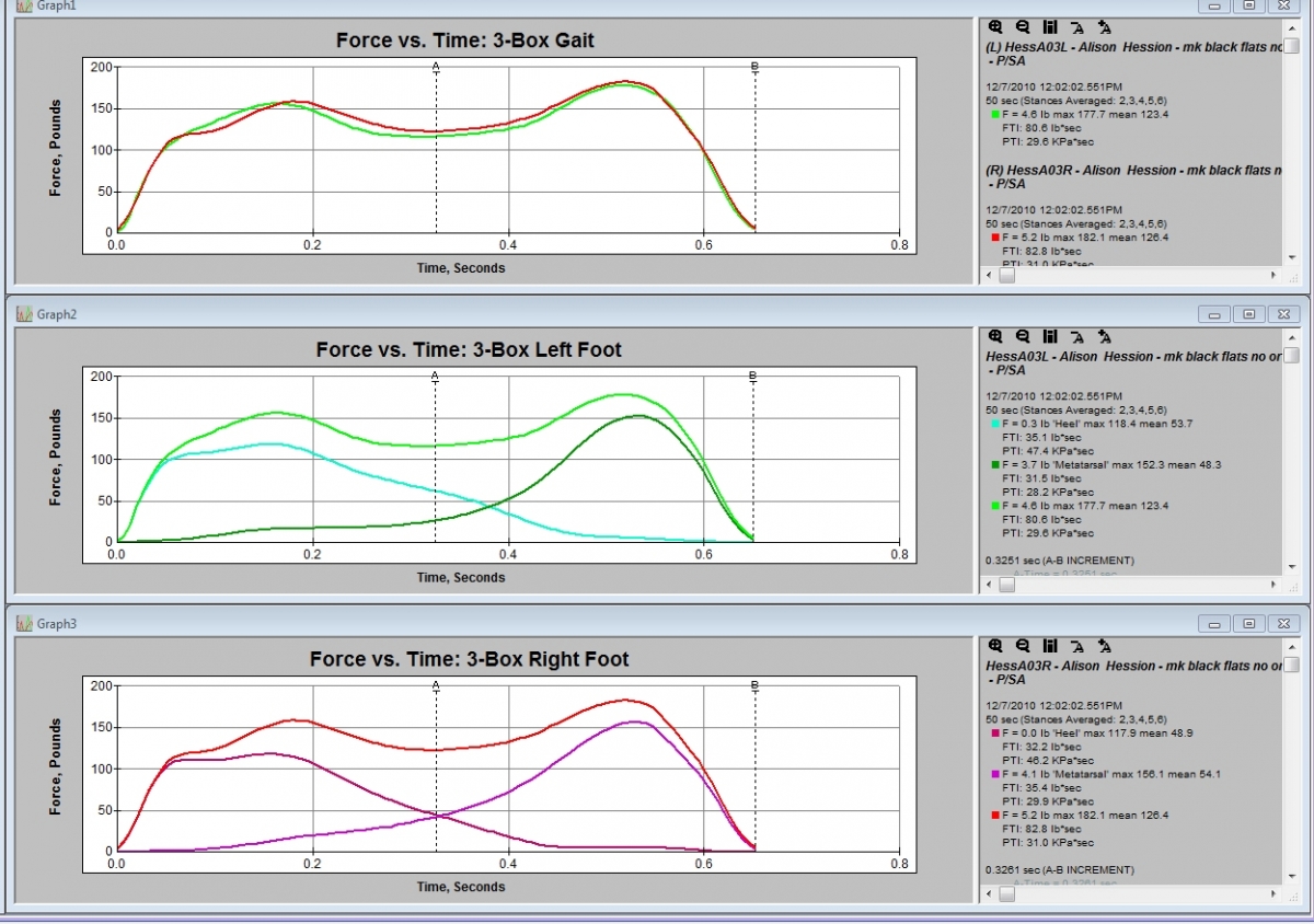 Human Gait Analysis Tekscan